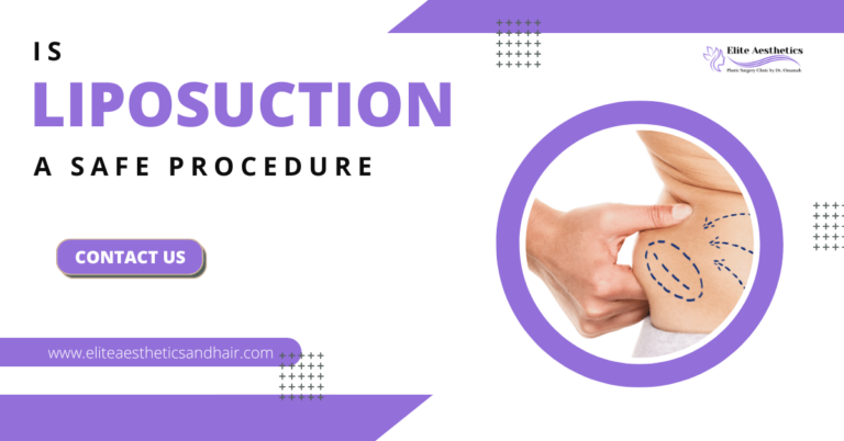 Is Liposuction a Safe Procedure? - Elite Aesthetic